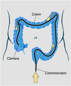Endoscopia y colonoscopia - Hospital Quirúrgico Norte
